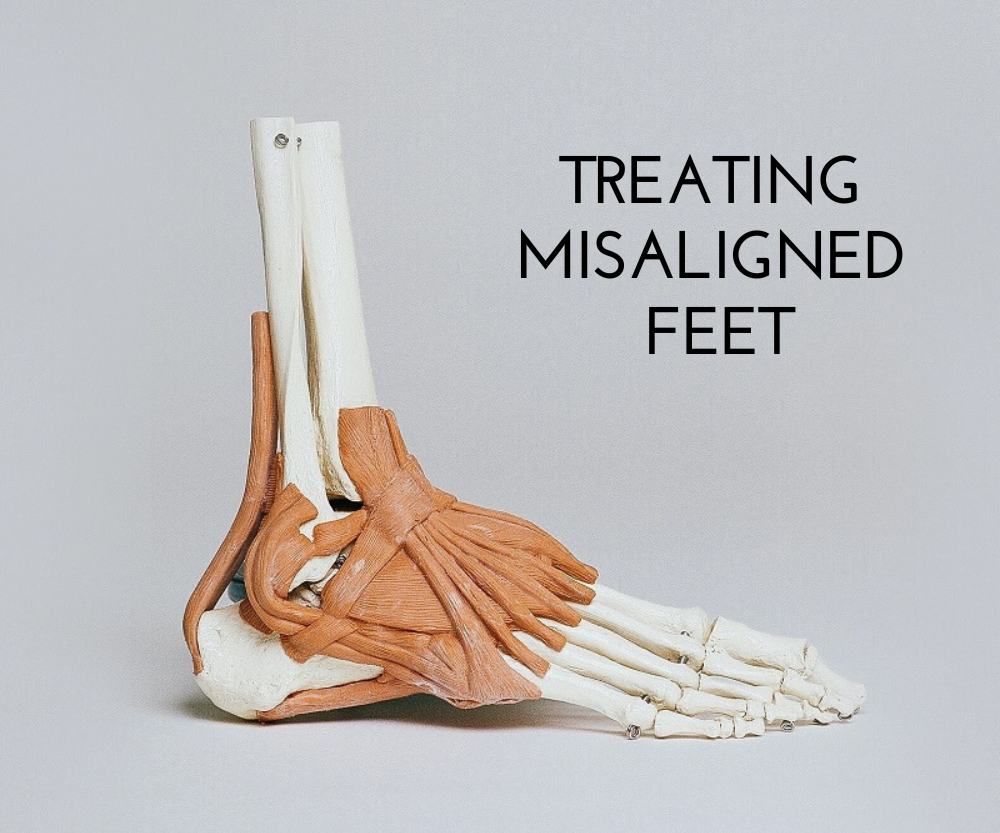 Treating Misaligned Feet | Walk NYC Podiatry, PC